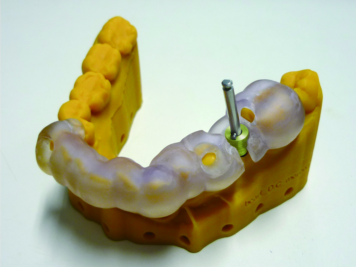 GUIDE SYSTEM IMPLANT